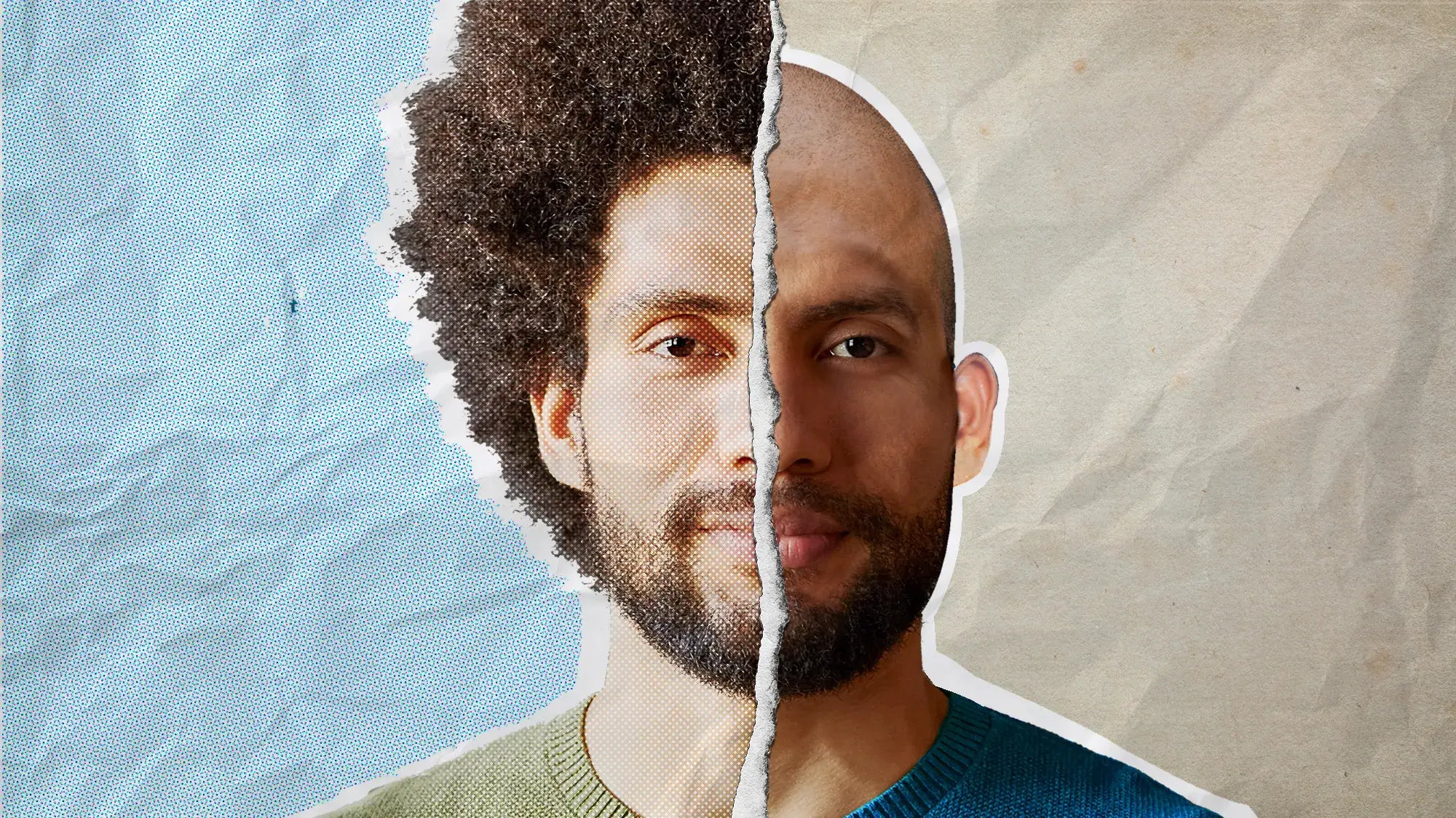 Understanding Men Balding: Emotional Support & Eco-Friendly Solutions ...